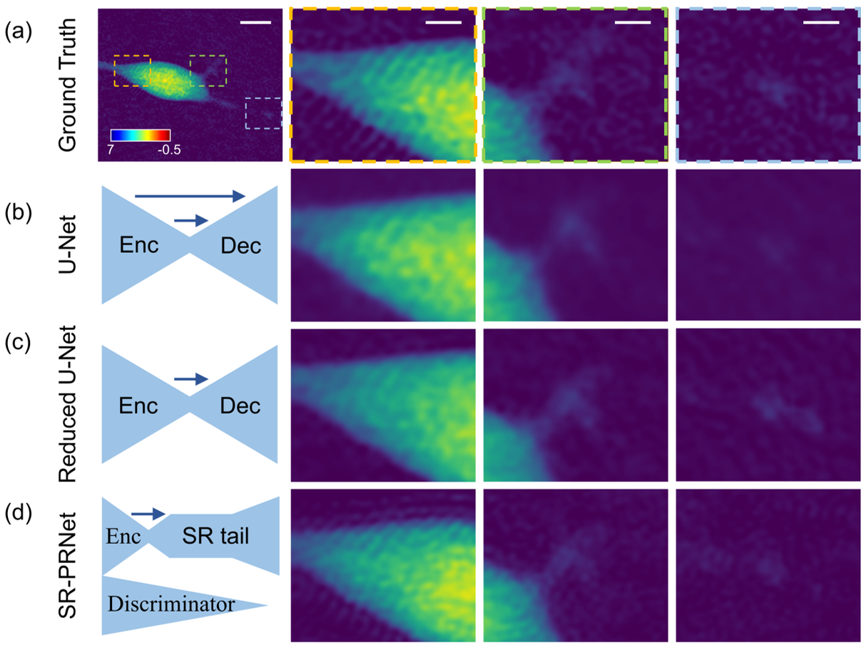 contrast between Unet baseline with SR-PR net